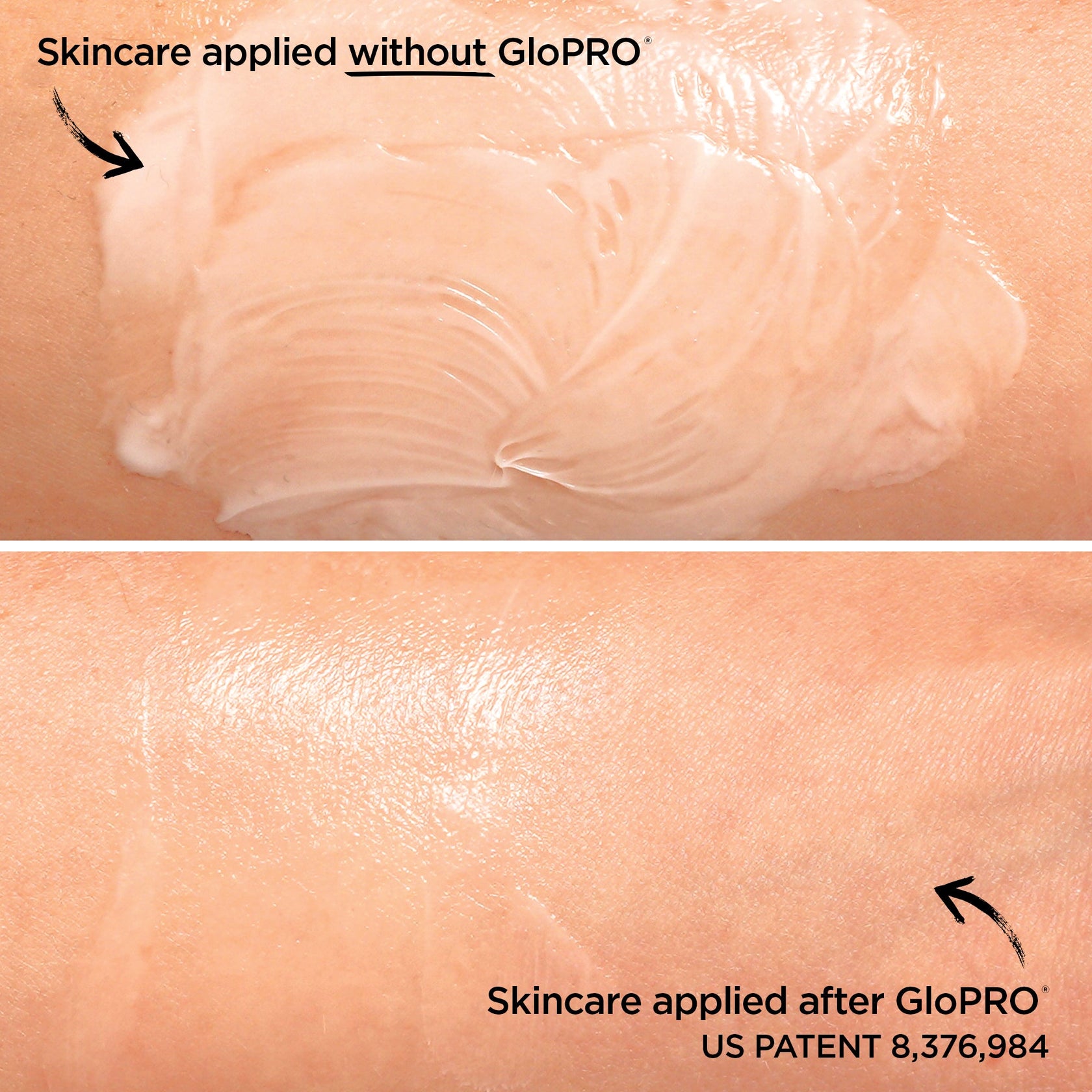 GloPRO® At-Home Microneedling Regeneration Tool | BeautyBio