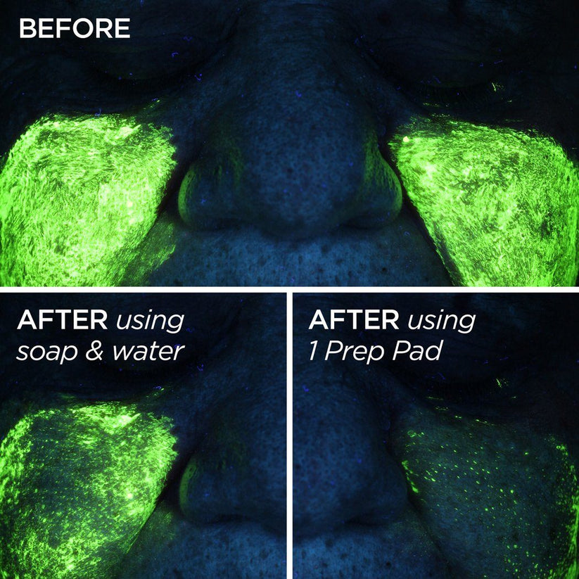 GloPRO® Skin Prep Pads for Microneedling | BeautyBio